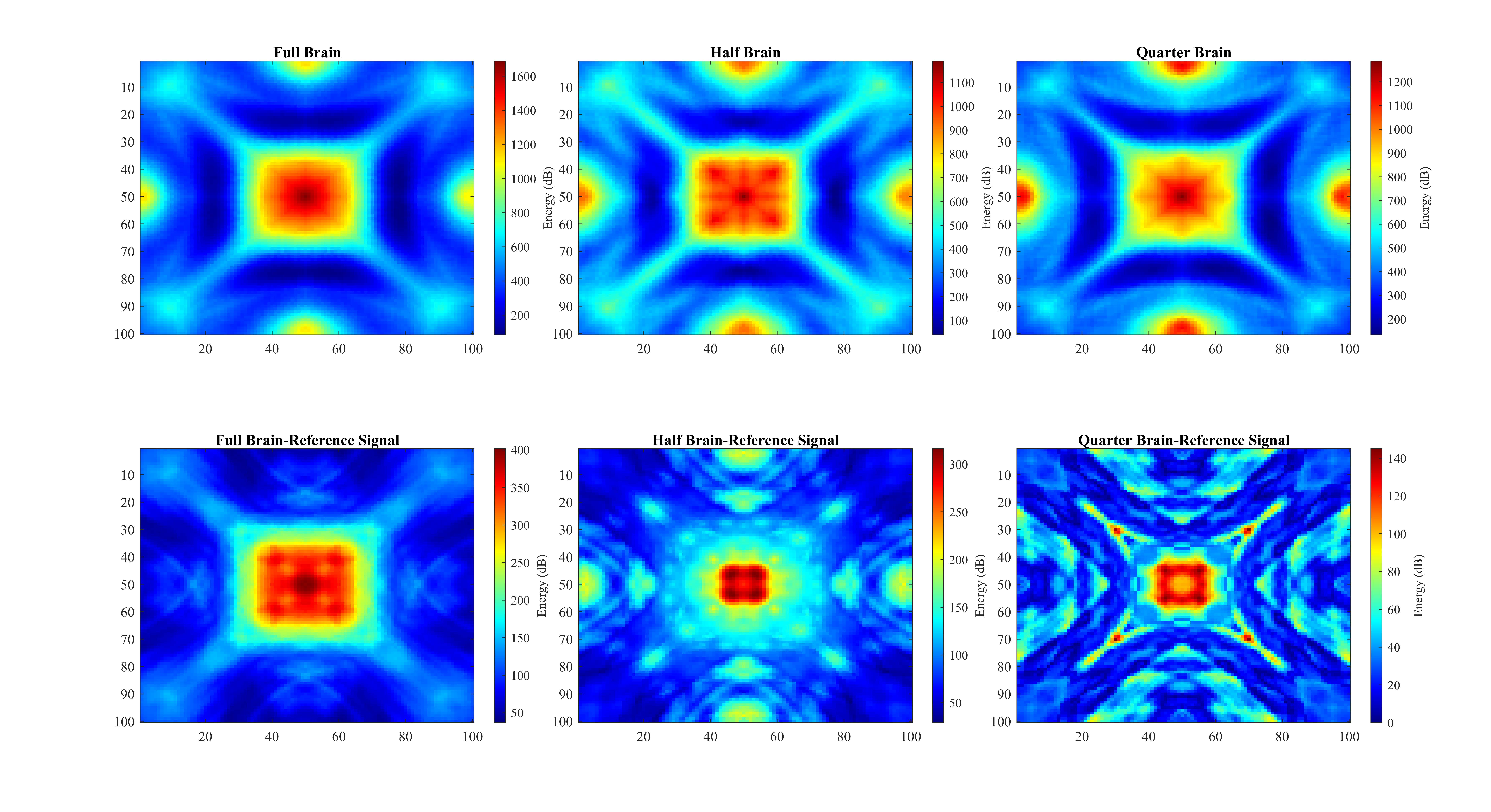 Processing and Imaging techniques for Microwave-Based Neurodegenerative Diseases Detection ...